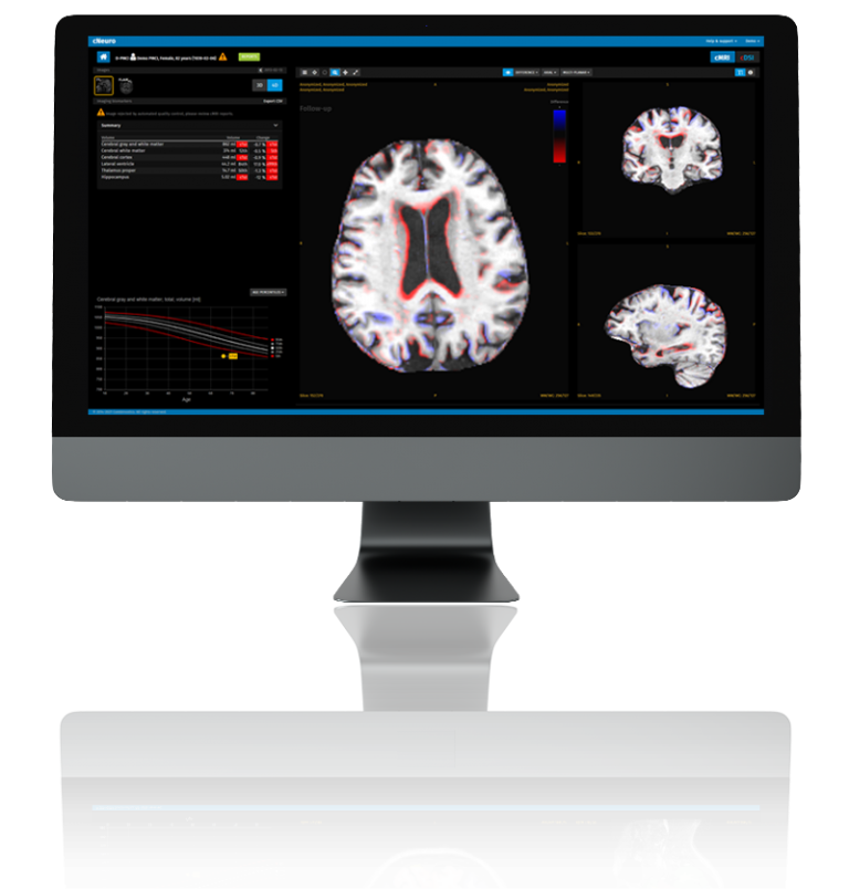 Combinostics | AI Technology to Support Early Diagnosis