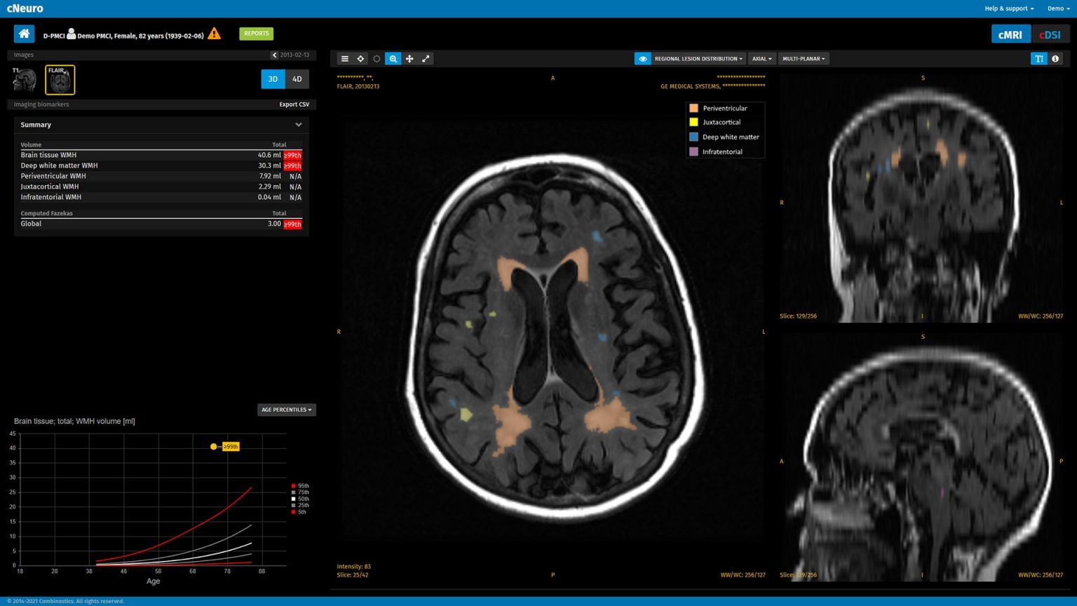 cNeuro cMRI - Combinostics