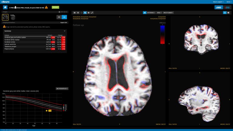 cNeuro cMRI - Combinostics