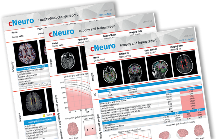 cNeuro cMRI - Combinostics