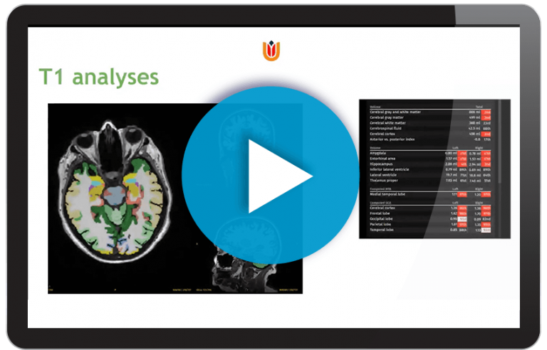 Downloads - Combinostics