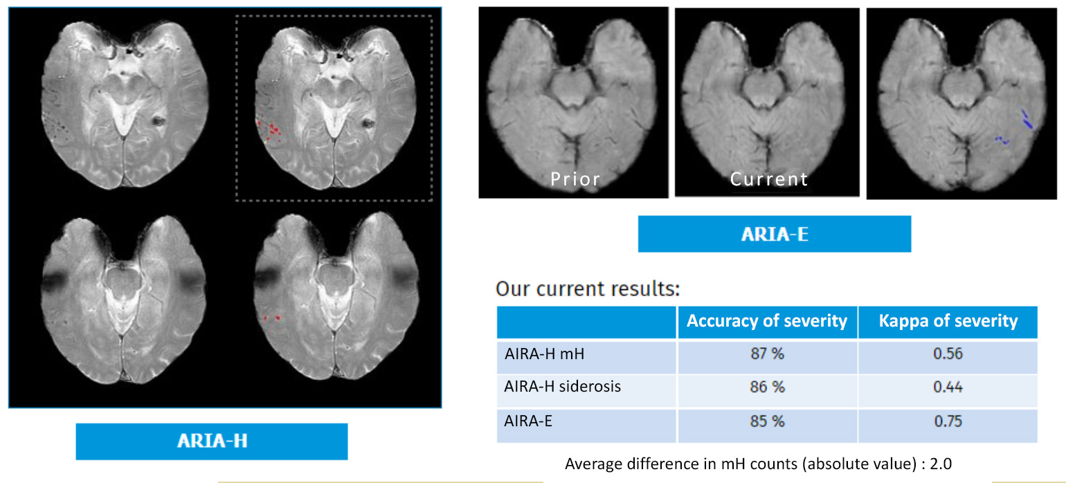 Imaging biomarkers play a crucial role in the development, approval ...