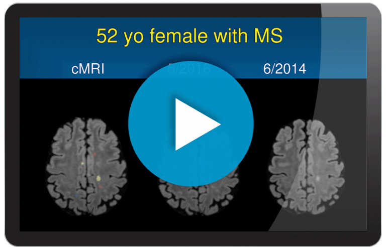Downloads - Combinostics