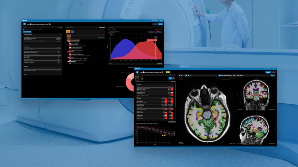 Combinostics’ cDSI and cMRI Applications, Part of the cNeuro Platform ...